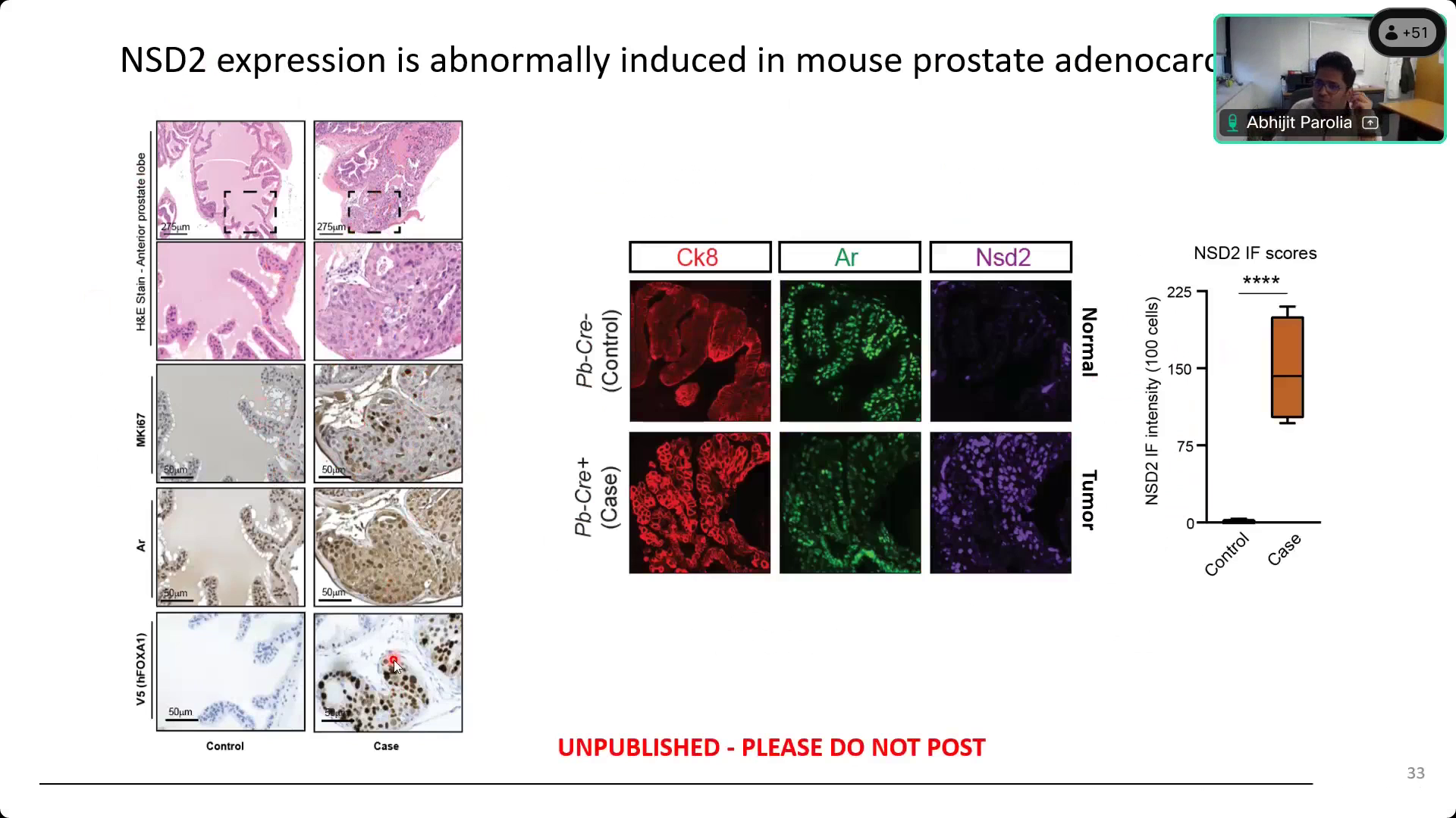 Slide 38/42 at 49:59: NSD2 expression is abnormally induced in mouse ...